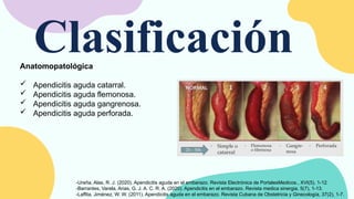Apendicitis_en_el_embarazo.pptx medicina | PPTX