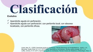 Apendicitis_en_el_embarazo.pptx medicina | PPTX