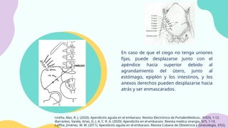 Apendicitis_en_el_embarazo.pptx medicina | PPTX