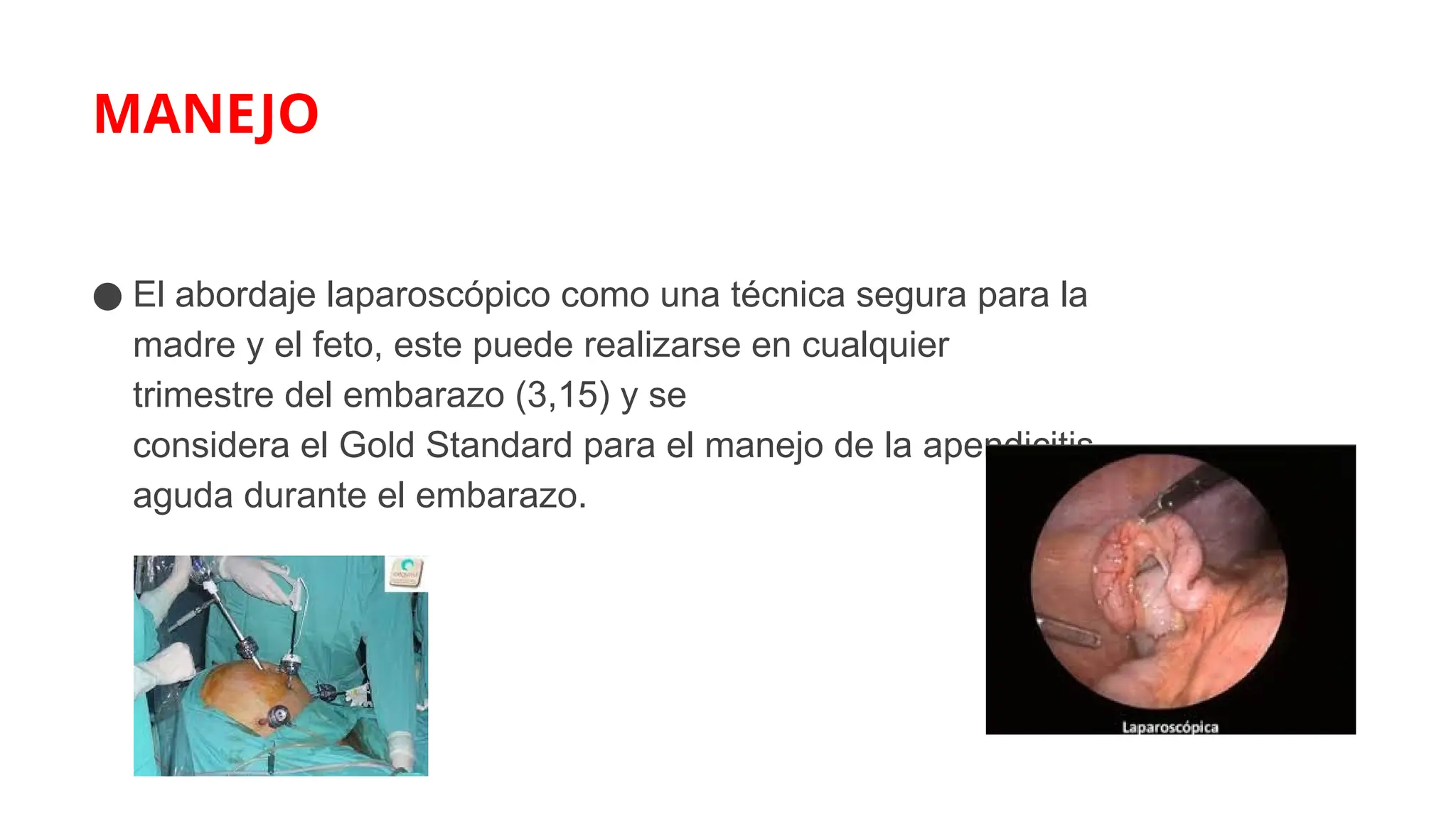 apendicitis en el embarazo tratamiento.pptx