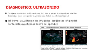apendicitis en el embarazo tratamiento.pptx