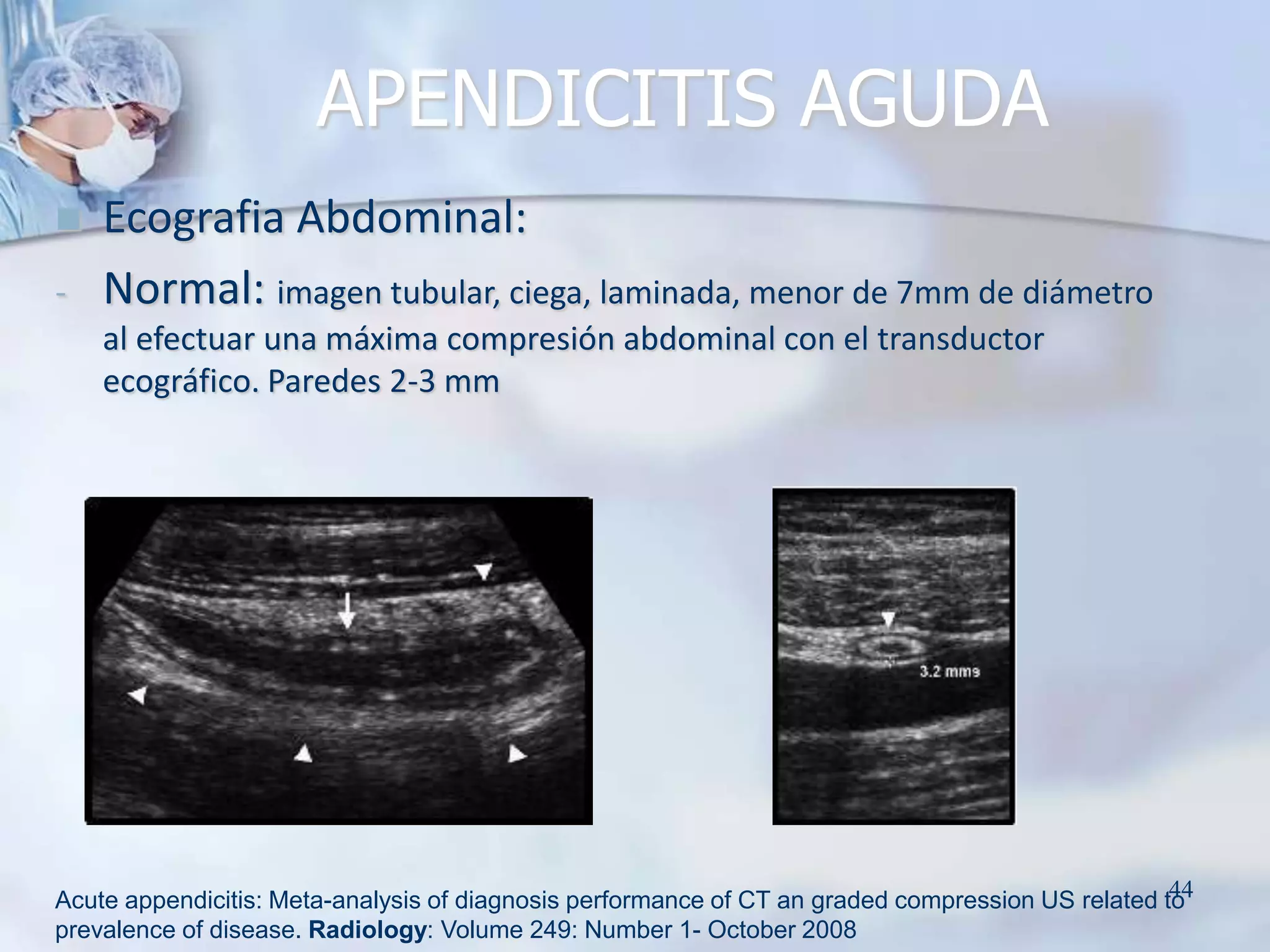 Apendicitis Aguda : Manejo y Técnica quirurgica | PPTX