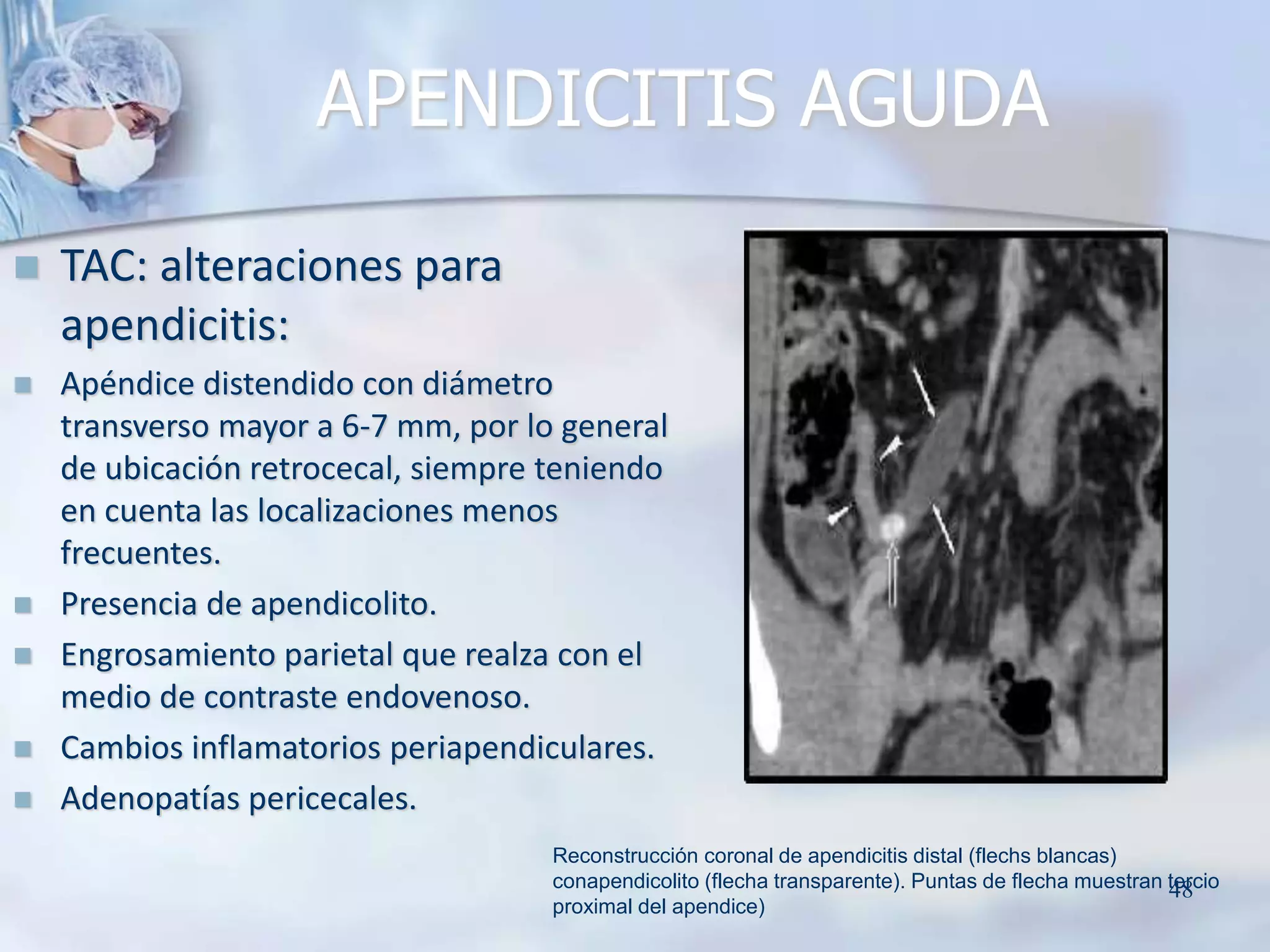 Apendicitis Aguda : Manejo y Técnica quirurgica | PPTX
