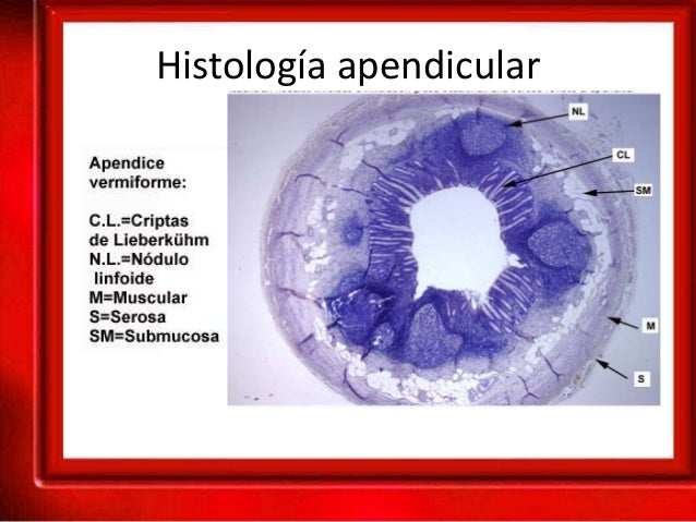 Apendicitis imagenologia