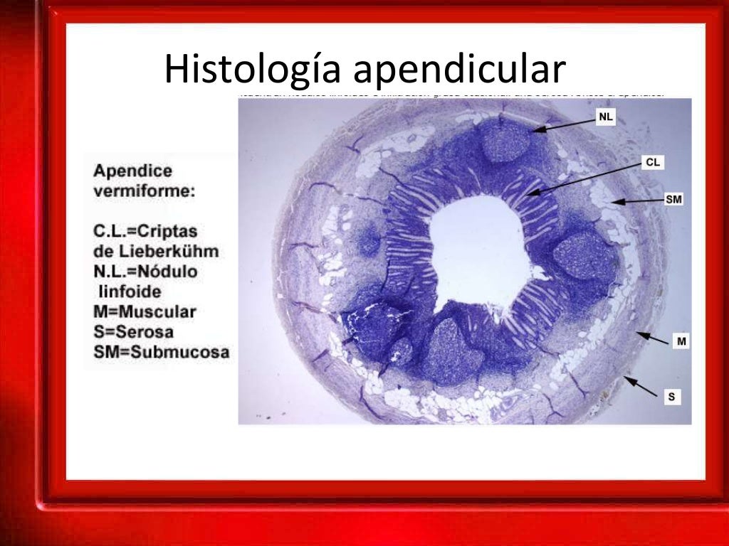 Apendicitis imagenologia