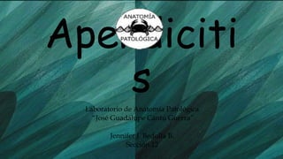 Apendicitis, definicion, epidemiologia, fases y escalas diagnosticas | PPT