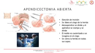 APENDICITIS AGUDA...................pptx