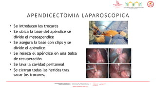 APENDICITIS AGUDA...................pptx