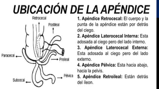 APENDICITIS punto jhosmer.pptx
