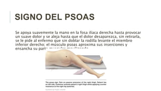 Apendicitis aguda Hospital General Celaya | PPTX