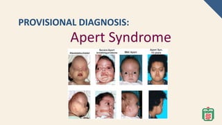 Apert Syndrome | PPTX
