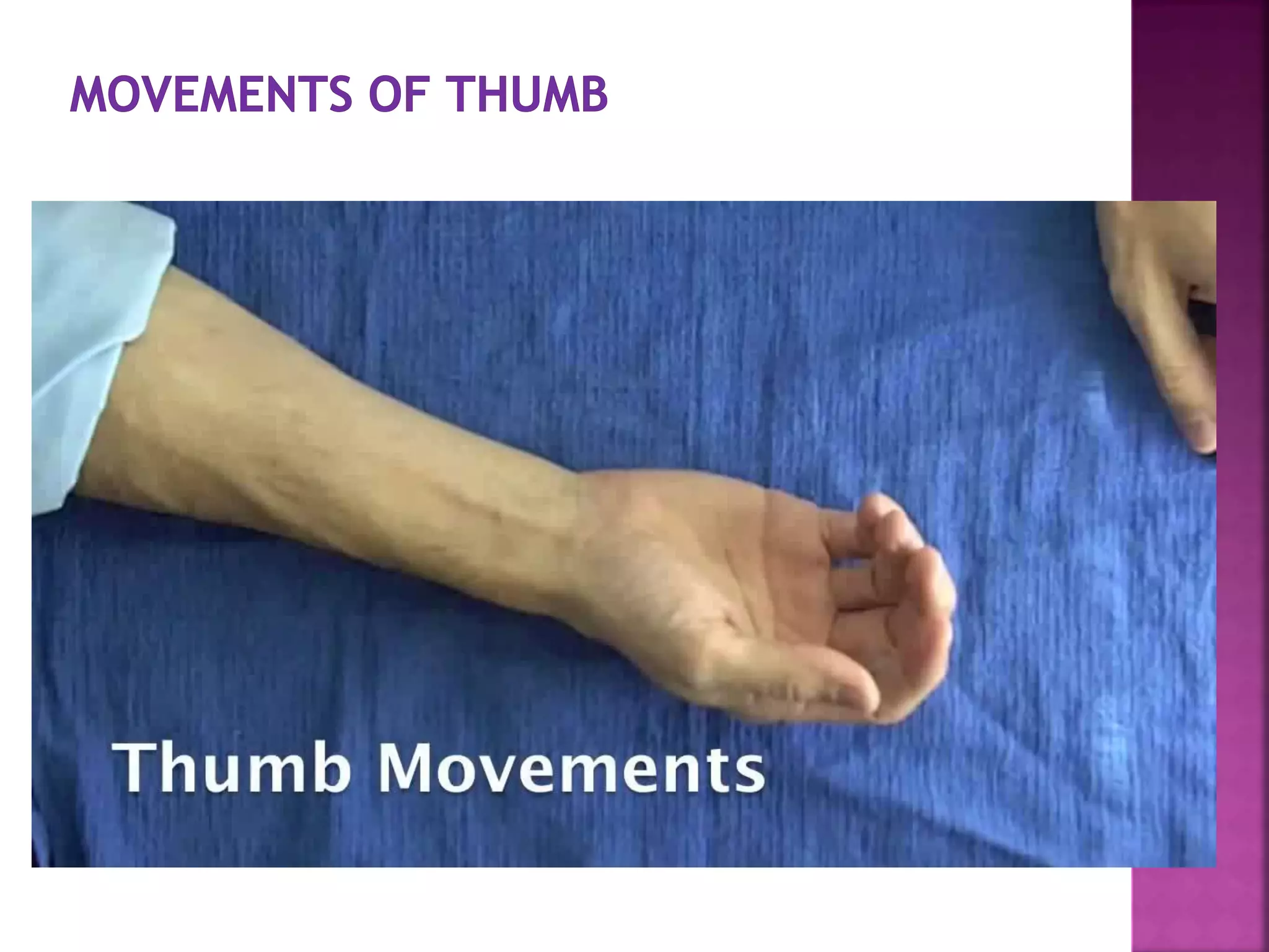 Ape thumb deformity to publish | PPTX