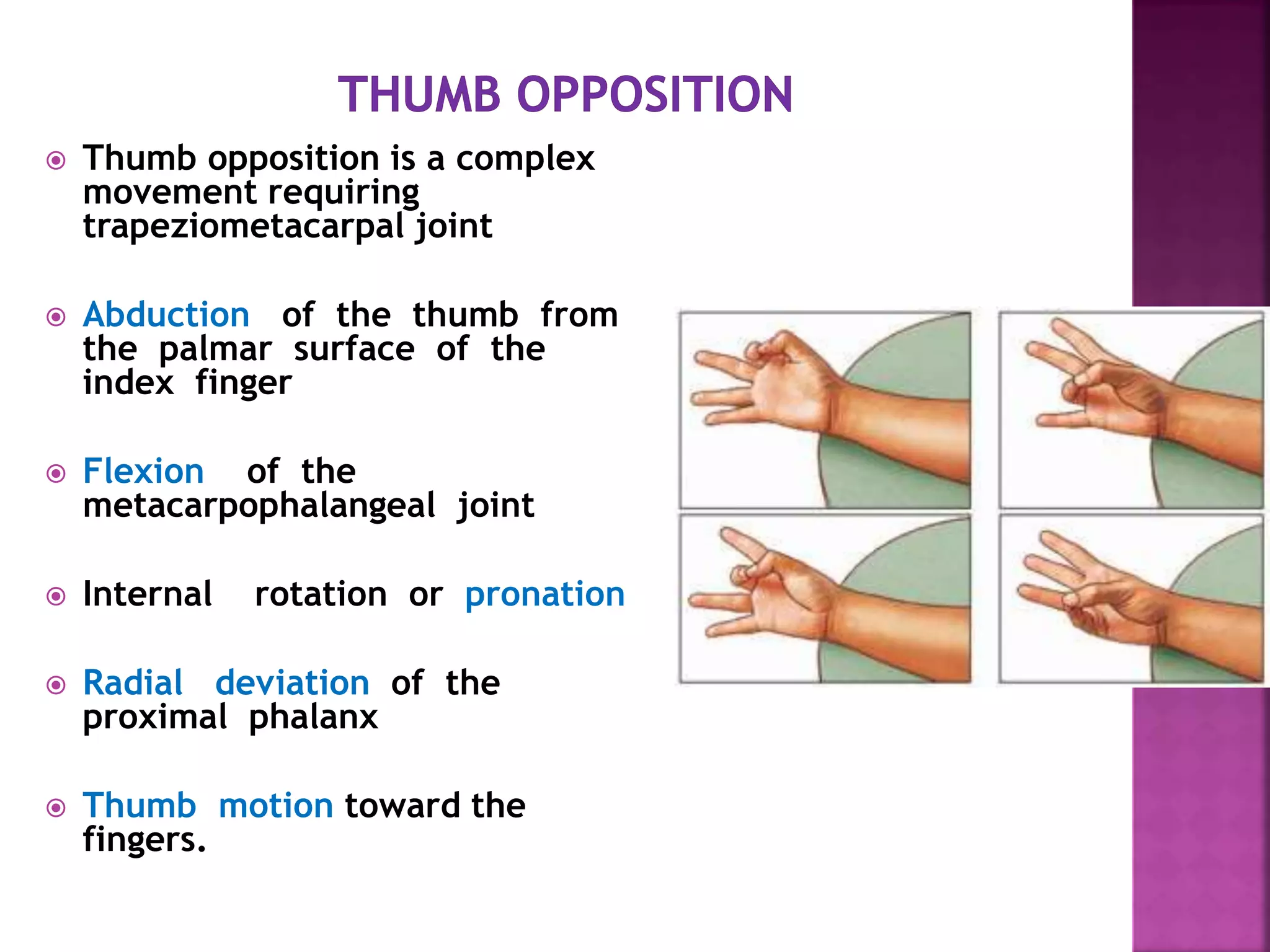 Ape thumb deformity to publish | PPTX
