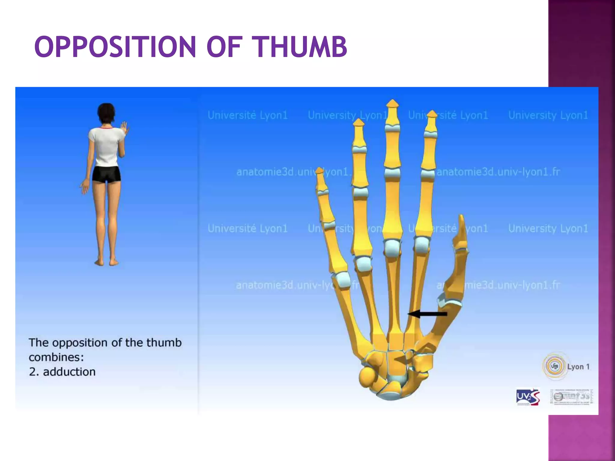 Ape thumb deformity to publish | PPTX