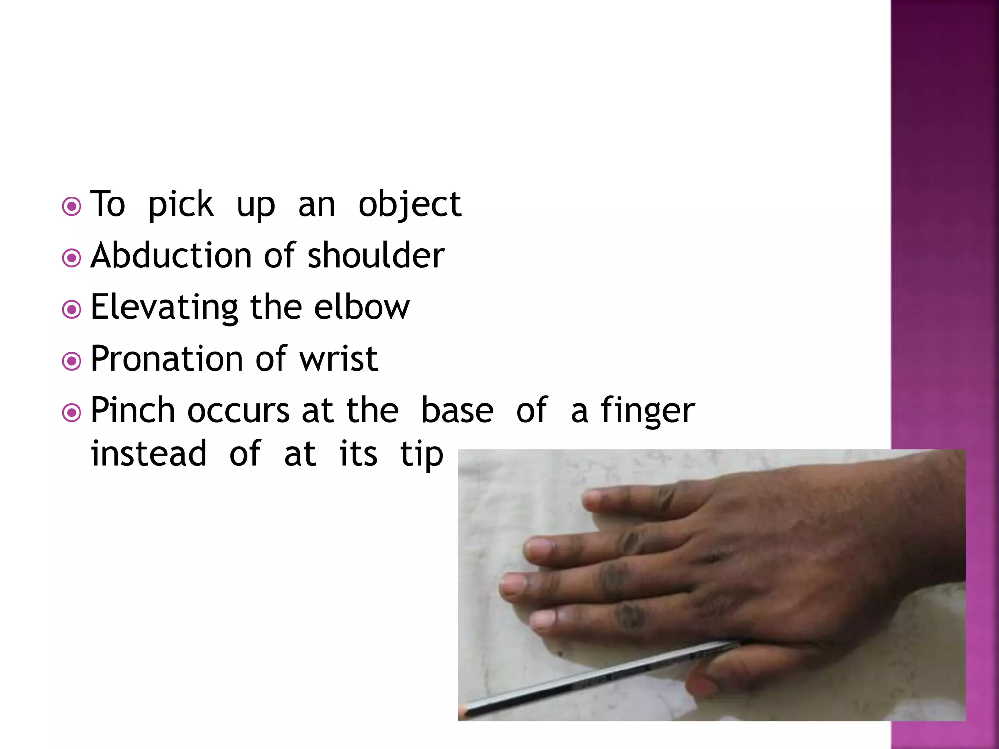 Ape thumb deformity to publish | PPTX