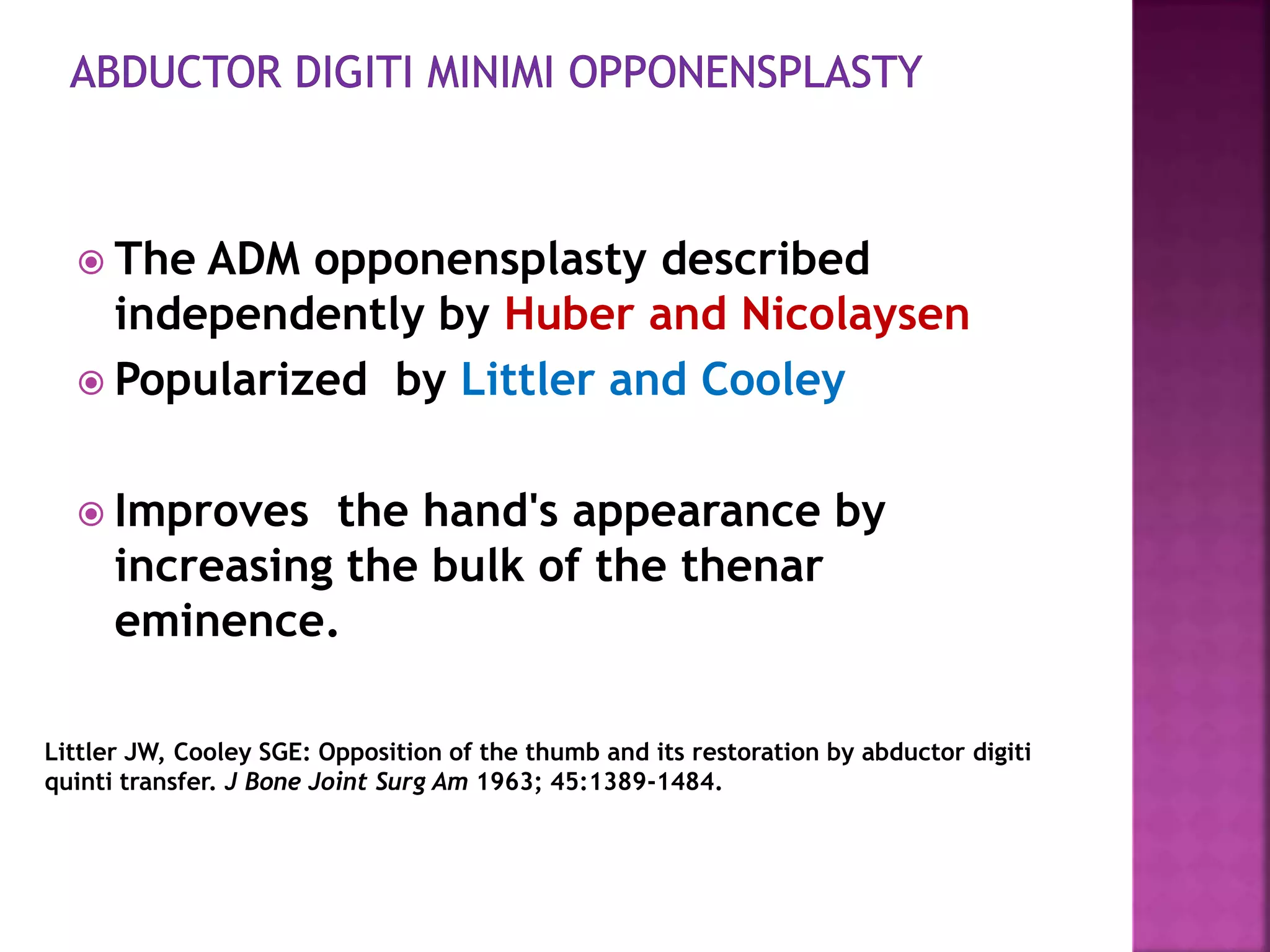 Ape thumb deformity to publish | PPTX