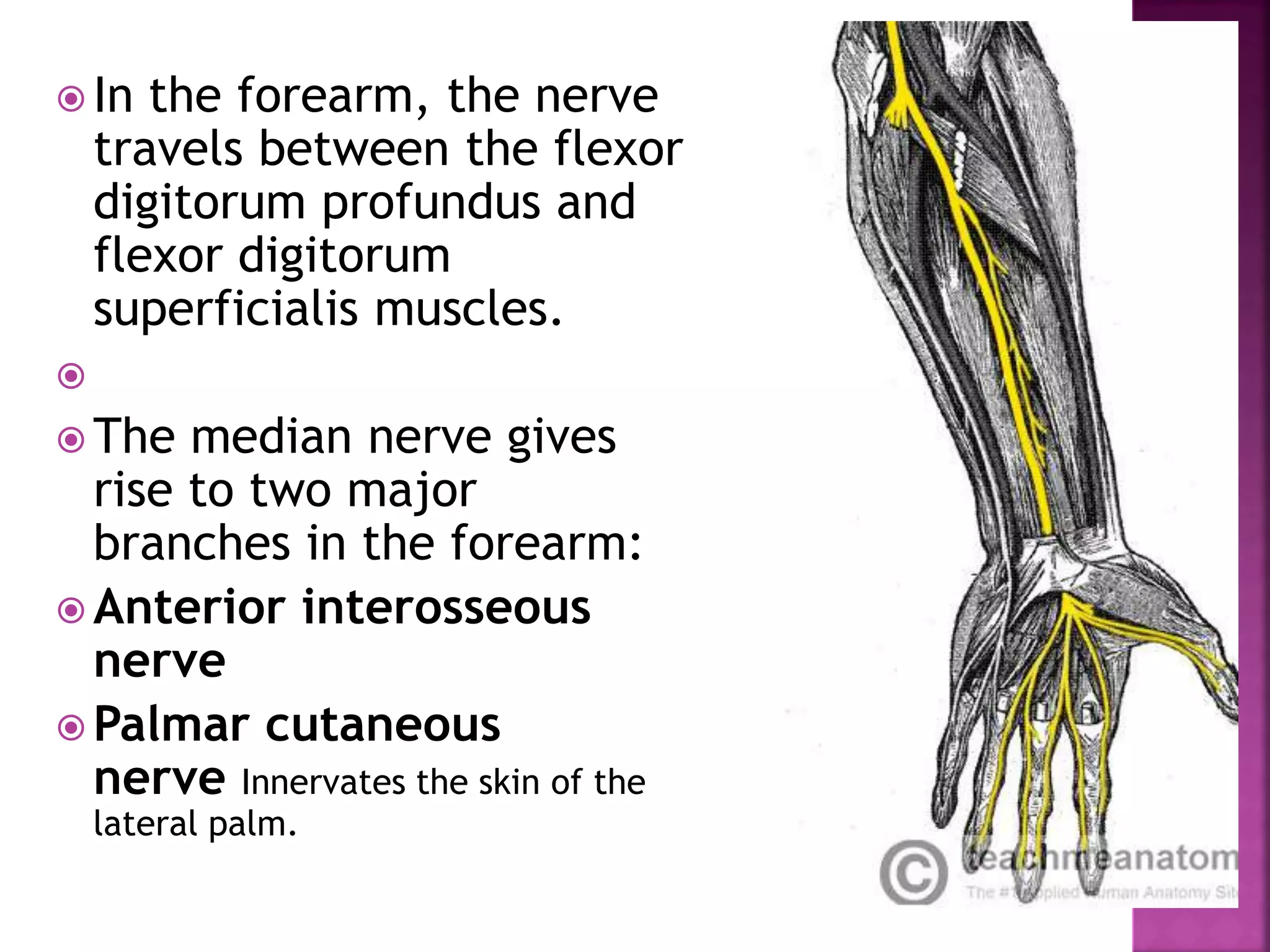 Ape thumb deformity to publish | PPTX
