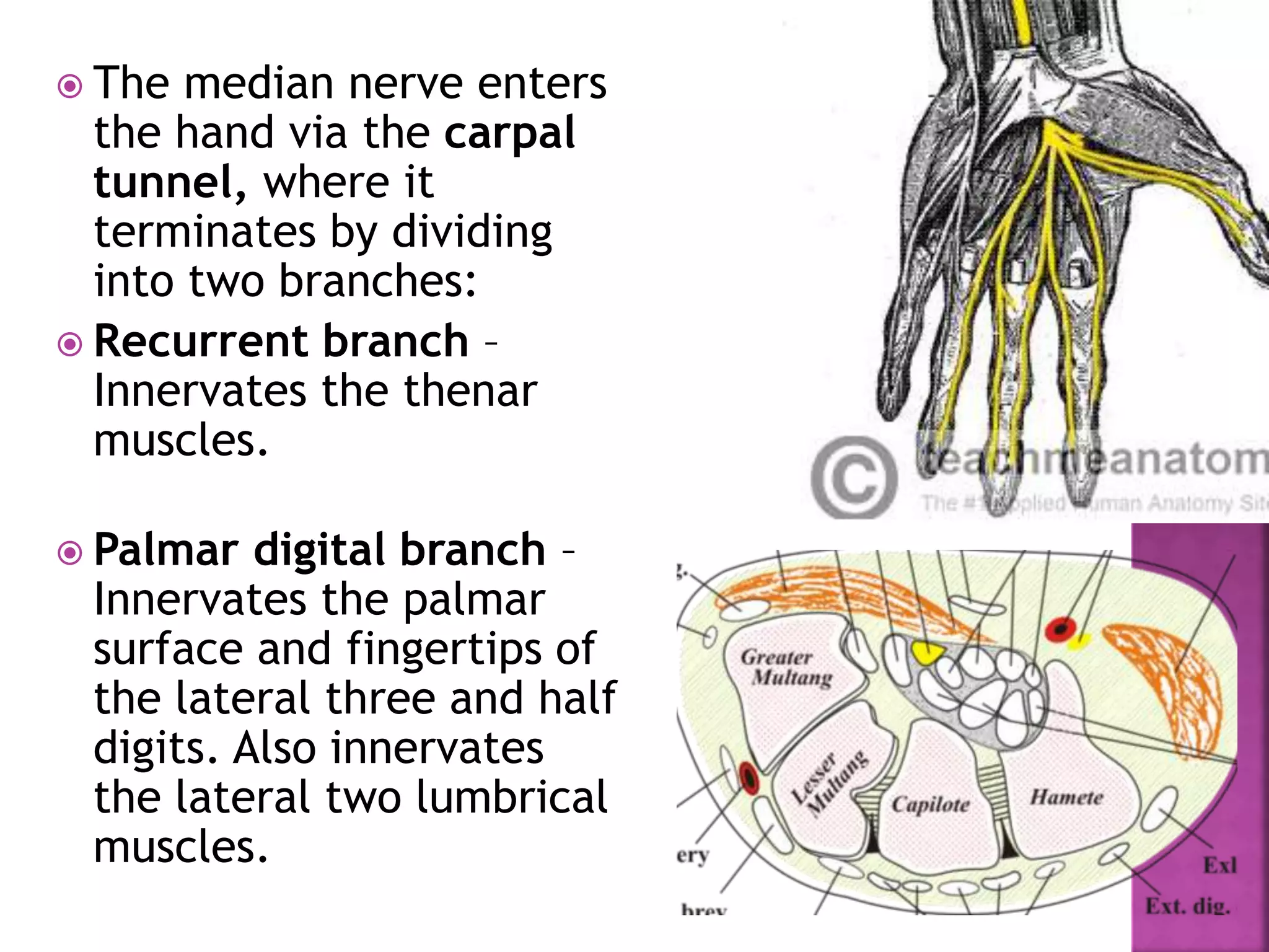 Ape thumb deformity to publish | PPTX