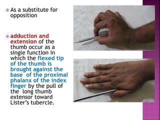 Thumb Extension Deformity
