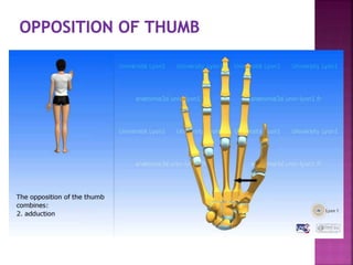 Ape thumb deformity to publish
