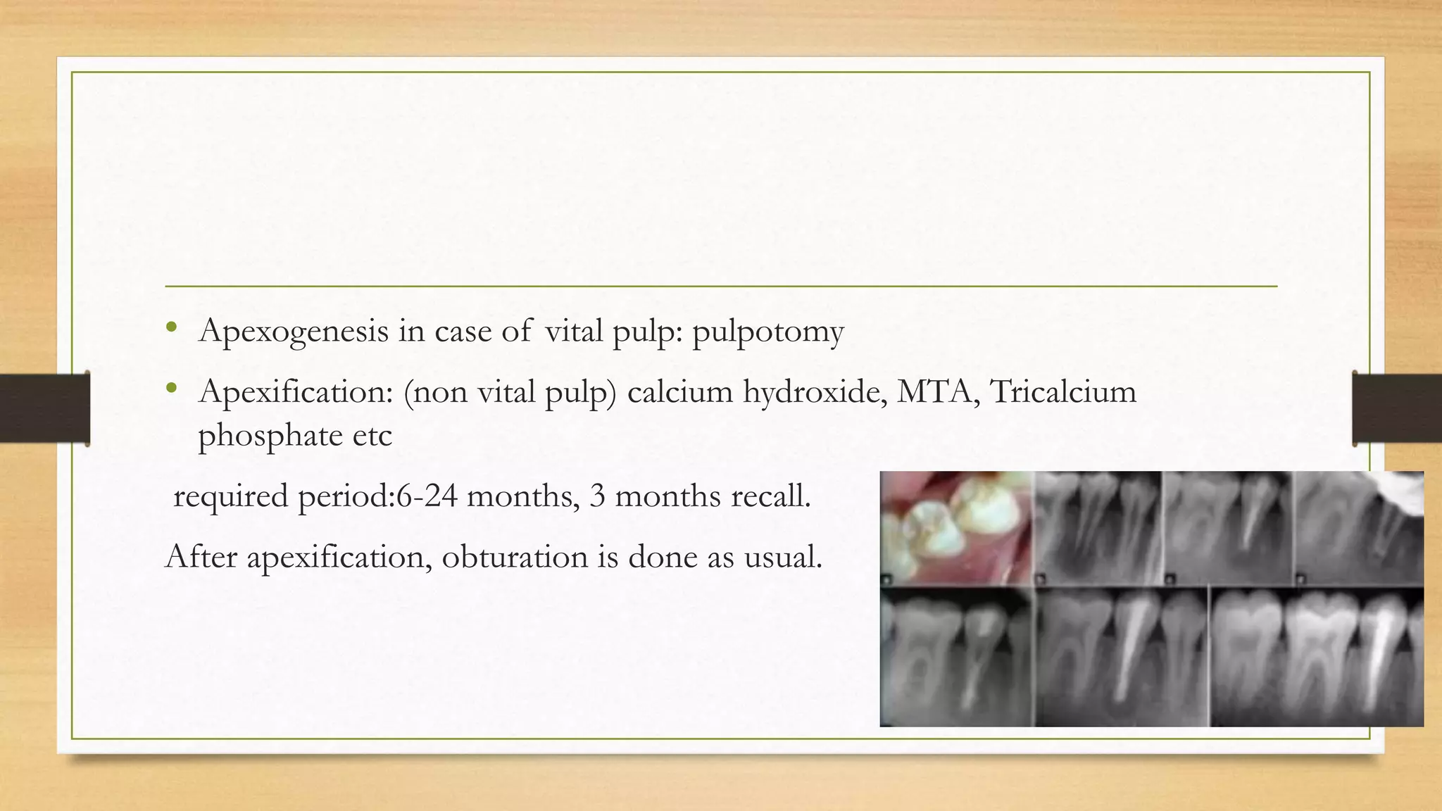 Apex and its significance in endodontics | PPTX