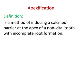 Apexification | PPTX