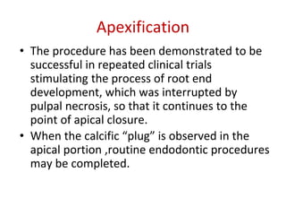 Apexification | PPTX