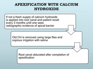 Apexification | PPTX