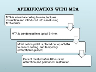 Apexification | PPTX