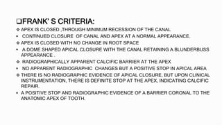 Apexification in endodontics PowerPoint presentation | PPTX