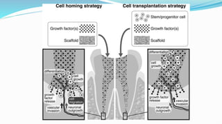 Apexification in endodontics PowerPoint presentation | PPTX