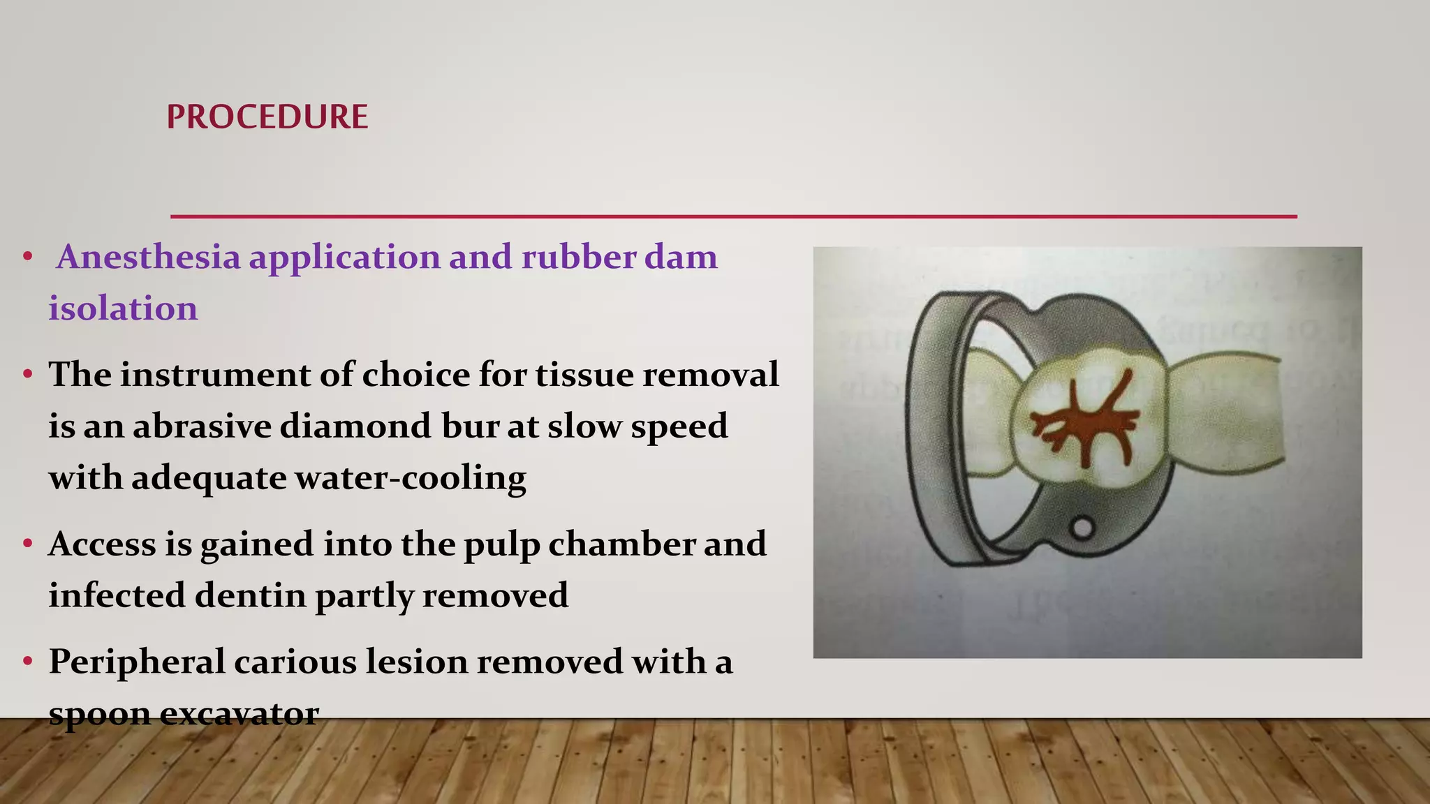 Apexification and Apexogenesis | PPTX