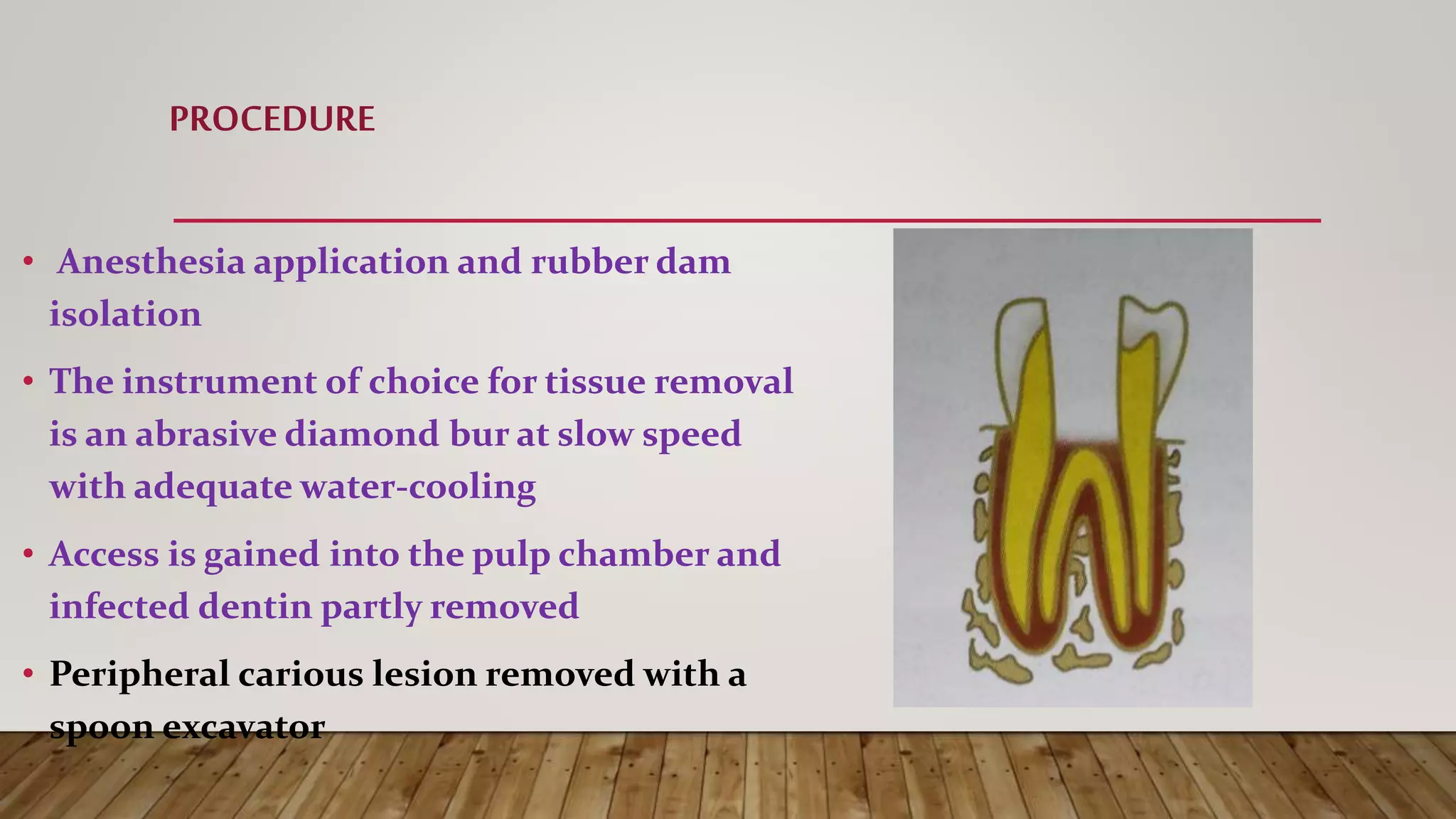 Apexification and Apexogenesis | PPTX