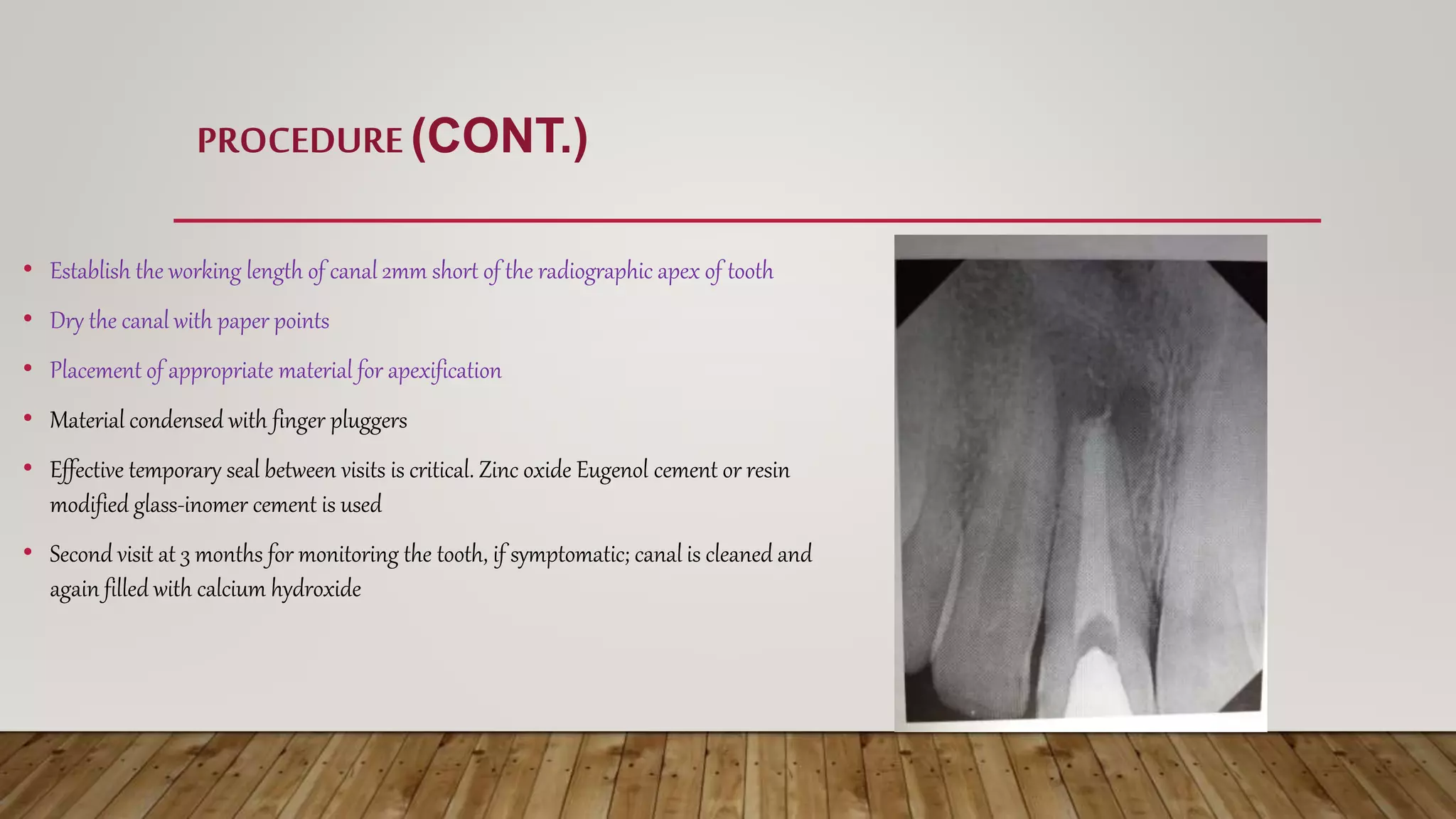 Apexification and Apexogenesis | PPTX