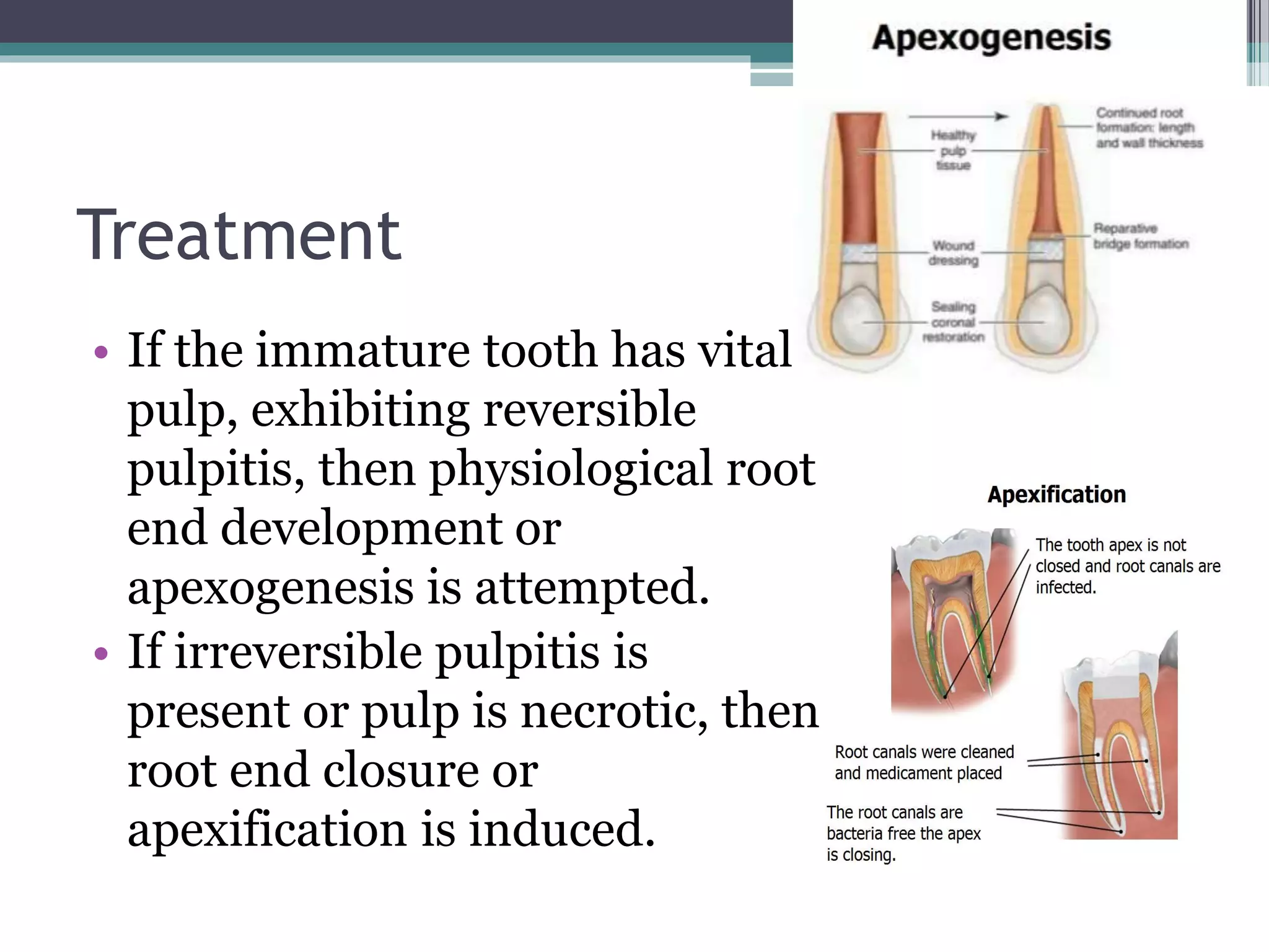 Apexification & apexogenesis | PPTX
