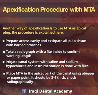 Apexification Procedure - Pediatric Dental Lecture | PDF