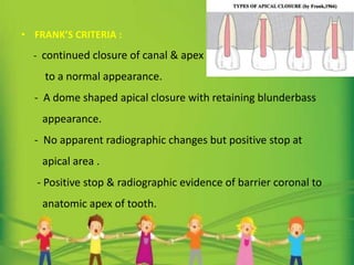 Apexifications in pediatric patient.pptx