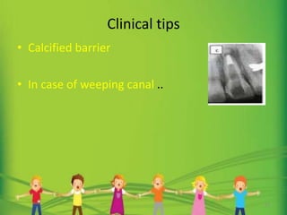 Apexifications in pediatric patient.pptx