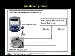 Apex locator / dental implant courses | PPTX