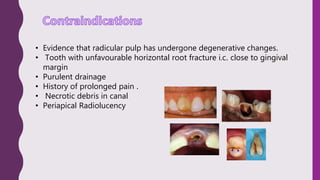 Apexogenesis and apexification | PPTX