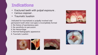 Apexogenesis and apexification | PPTX
