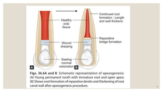 Apexogenesis and apexification.pptx endodontics final year | PPTX