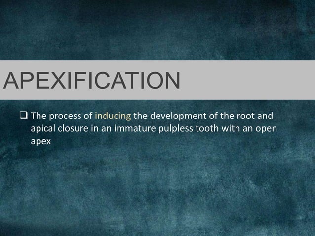Apexogenesis & apexification | PPTX | Dental Health | Diseases and ...