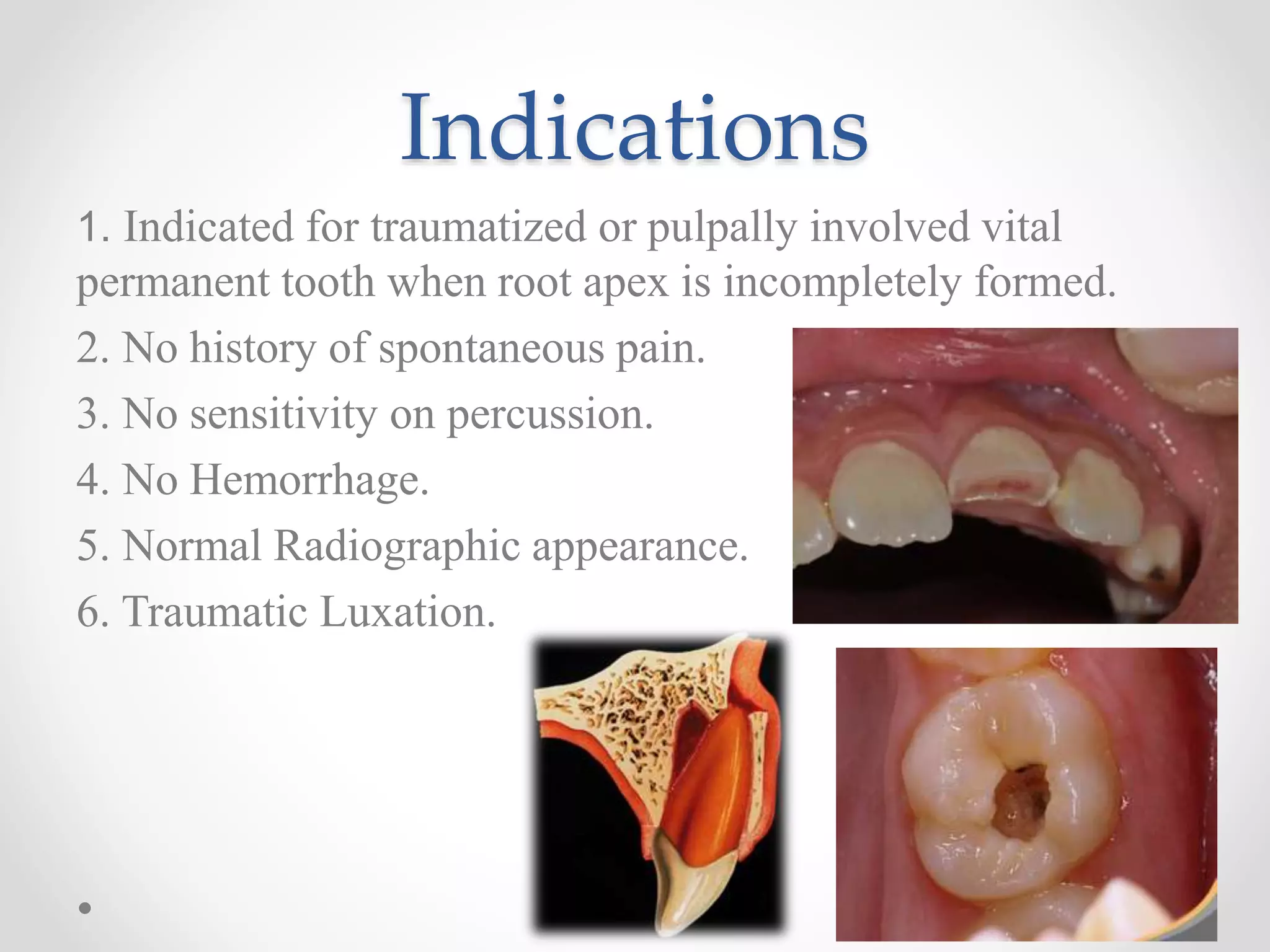 Apexogenesis & apexification in pediatric dentistry | PPTX