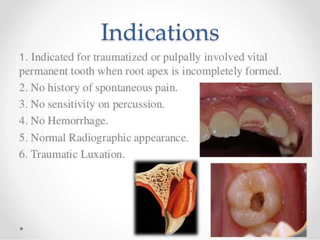 Apexogenesis & apexification in pediatric dentistry