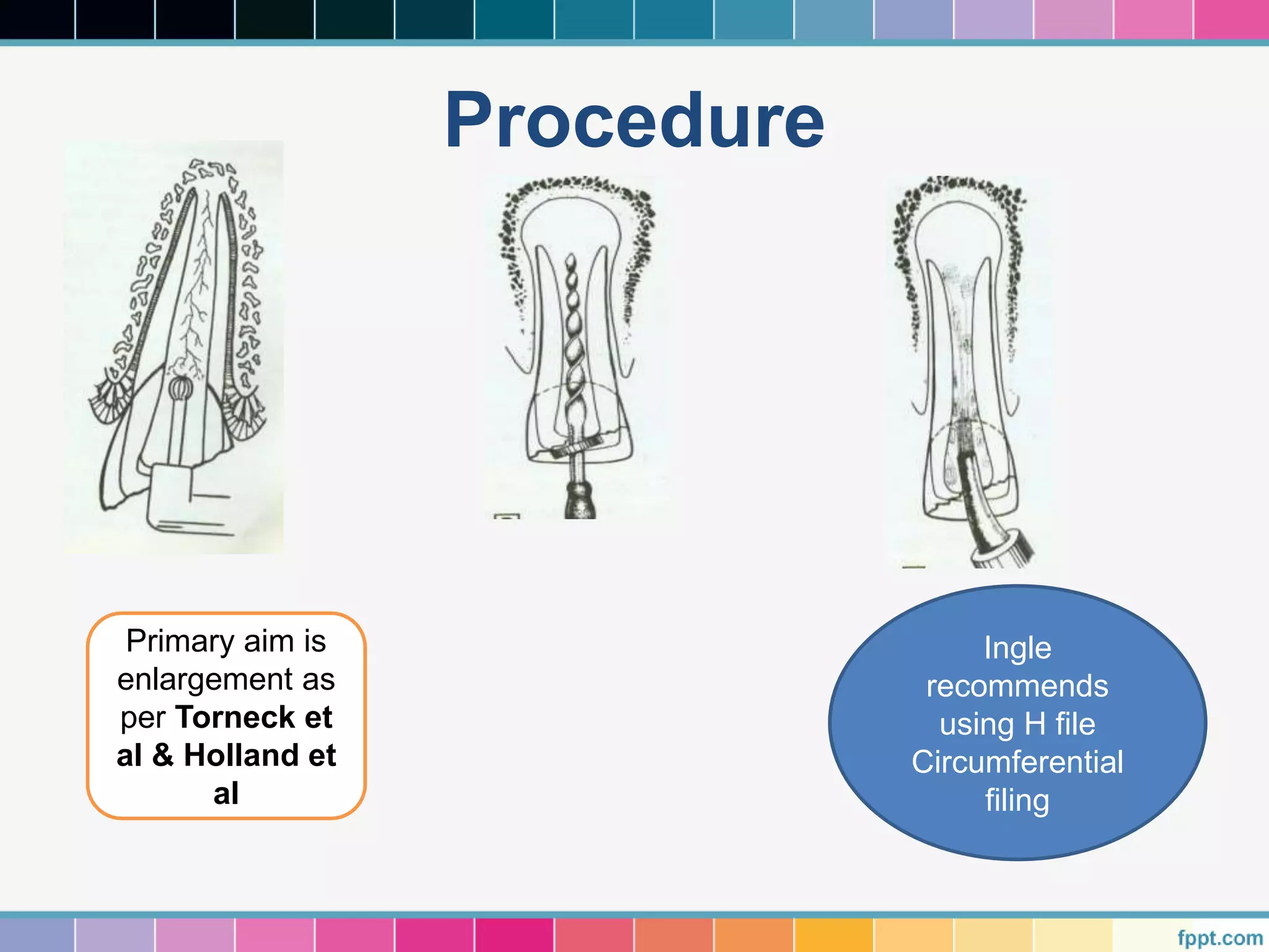 Apexogenesis & apexification | PPTX
