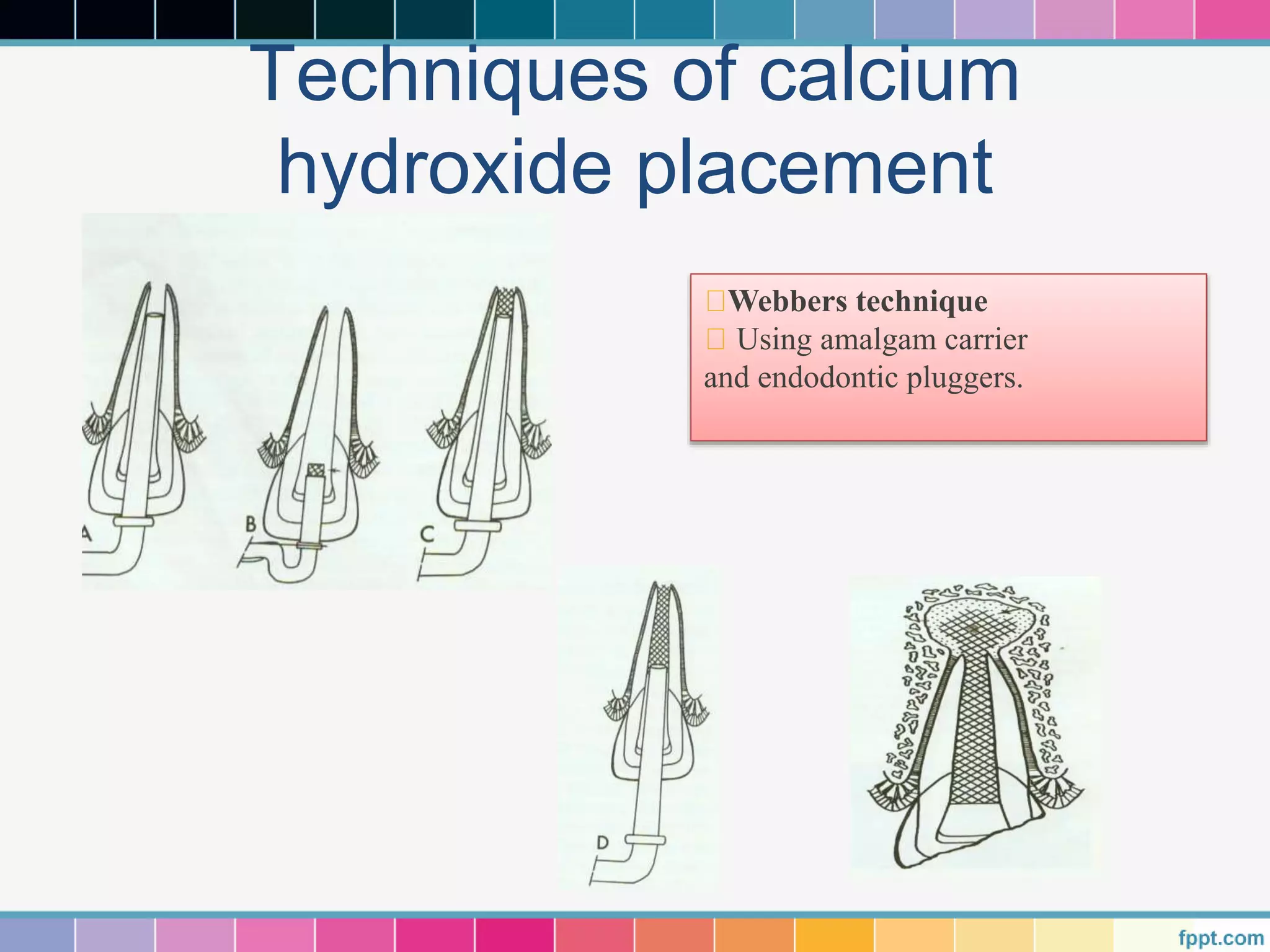 Apexogenesis & apexification | PPTX