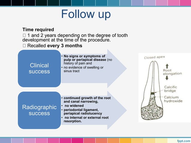 Apexogenesis & apexification | PPTX | Dental Health | Diseases and ...