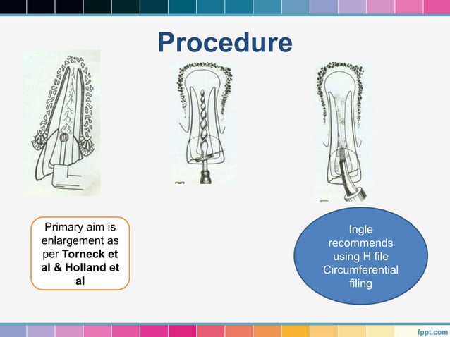 Apexogenesis & apexification | PPTX | Dental Health | Diseases and ...