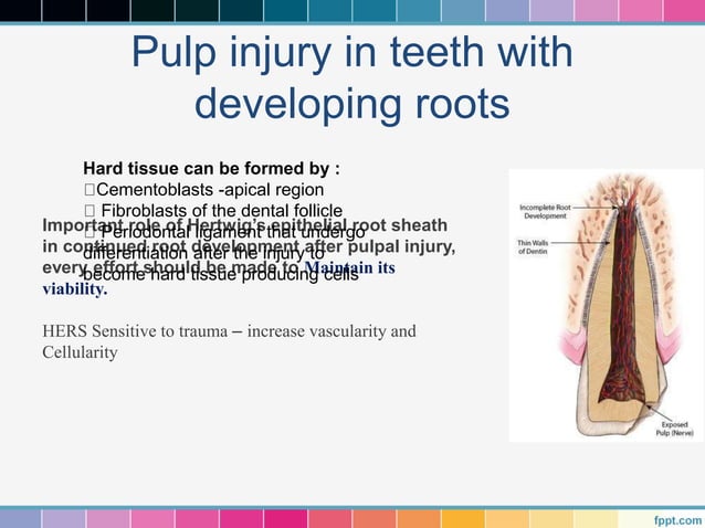 Apexogenesis & apexification | PPTX | Dental Health | Diseases and ...